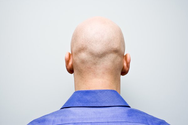 Bald in Spanish | English to Spanish Translation - SpanishDictionary.com