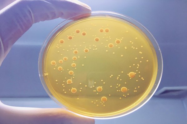 Bacteria en inglés | Traductor de español a inglés - inglés.com
