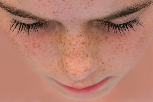 Freckle in Spanish | English to Spanish Translation - SpanishDictionary.com